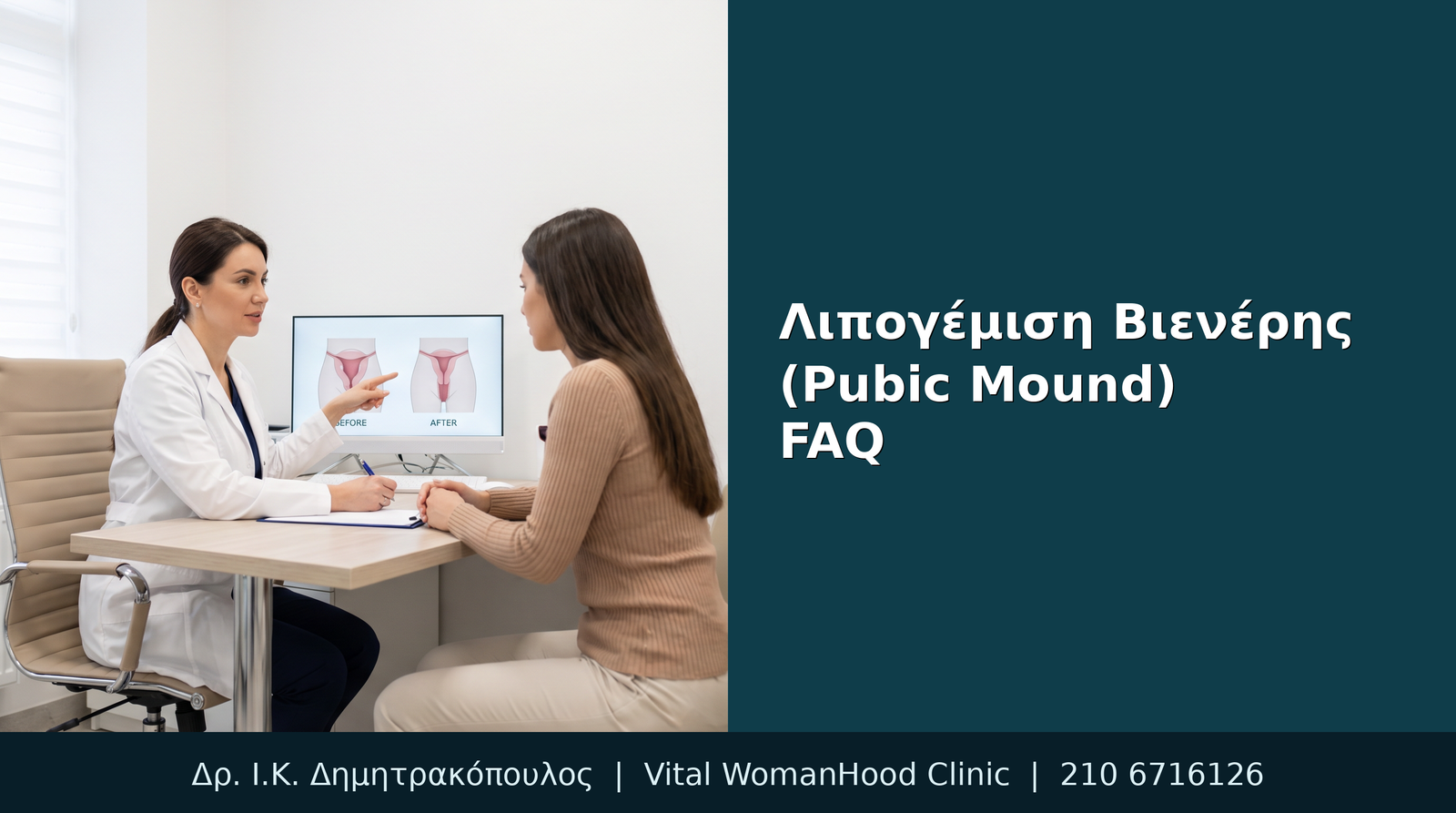 Λιπογέμιση Βιενέρης (Pubic Mound): FAQ - Δρ. Ιωάννης Κ. Δημητρακόπουλος ...