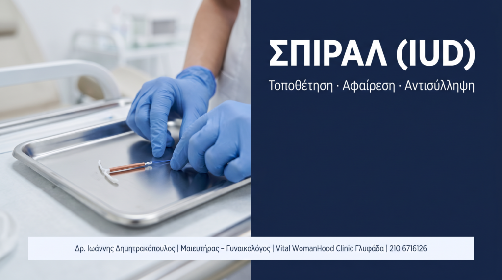 Σπιράλ (IUD): Ερωτήσεις & Απαντήσεις — Τοποθέτηση, Αφαίρεση και ...